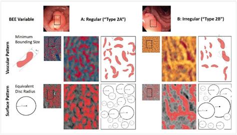 Bioinformatically Enhanced Endoscopy Bee Mathematical Analysis Of Download Scientific