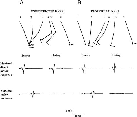 Patterns Of Knee Angular Displacement Are Illustrated With Stick