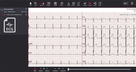 ecg module alemhealth