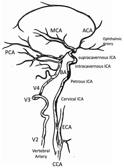 Anatomy Of Cerebral Arteries With Clinical Aspects In Patients With