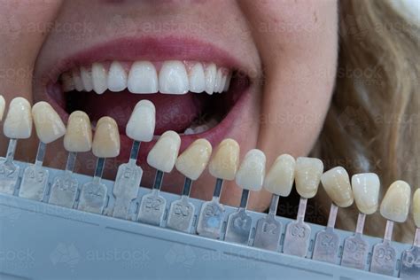 image of matching teeth colour with tooth shade guide austockphoto