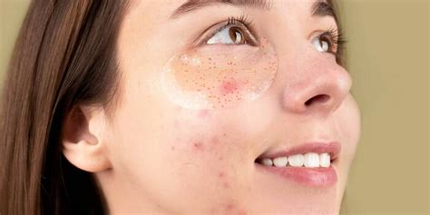 Sexe F Minin Comment Soigner Un Bouton Sur Les Parties Intimes Et Les Grandes L Vres A M