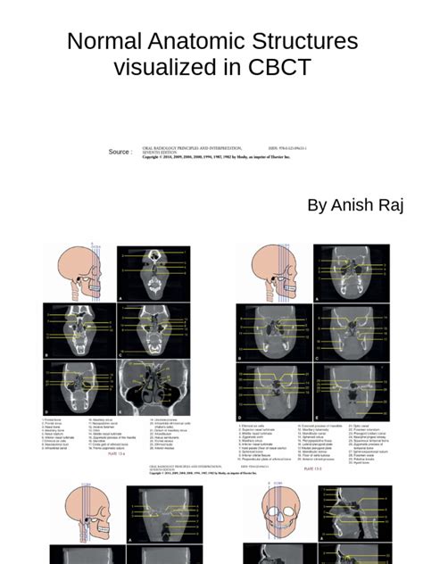 Normal Anatomy Cbct Pdf