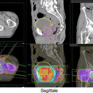1 The Male Reproductive System Illustration By Frank H Netter Download Scientific Diagram