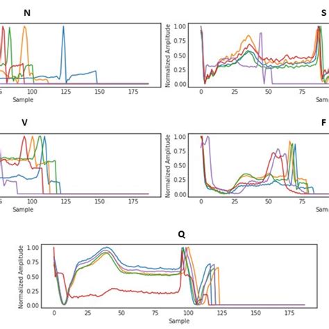 The Mit Bih Arrithimya Dataset Grouped Into Five Classes According To Download Scientific