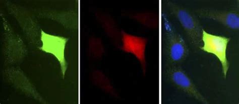 Sharpin抗体 Ab197853 Abcam中文官网