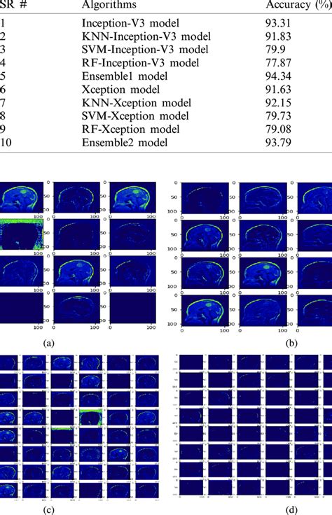 Accuracy Comparison Among The Proposed Models Download Scientific Diagram