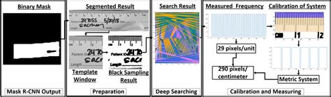 Overview Procedure Integration Of Mask Region Proposal Based