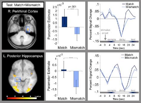 figure 4 from medial temporal lobe activity predicts successful
