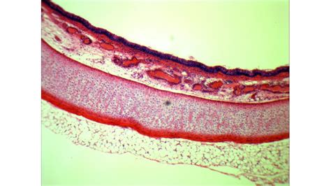 Solved On This Microscope Picture Which Is A Slide That