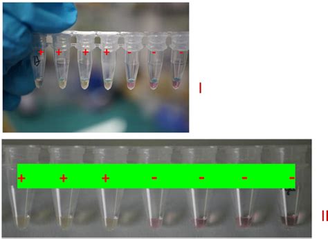 Colorimetric Lamp Assay Results Using Bacterial Lysates With Pantoea Download Scientific
