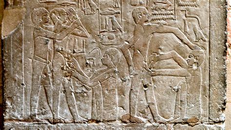 Snip Or Skip The Debate Over Circumcision