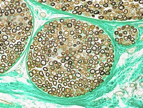 Peripheral Nerve By Science Photo Library