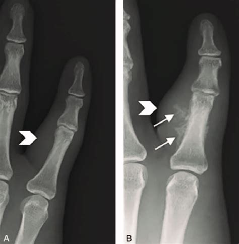 Radiological Investigation During The First Visit To Another Hospital