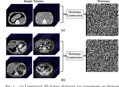 Figure 1 From 3d Feature Constrained Reconstruction For Low Dose Ct