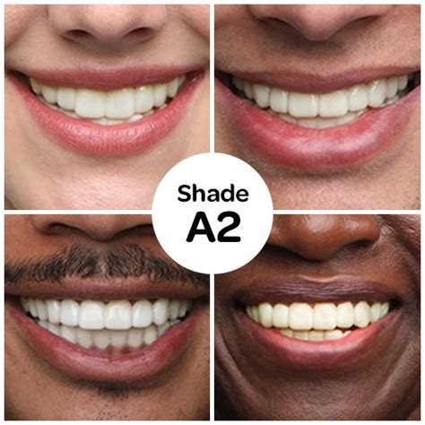 Does A2s Tooth Shade Appear White Business And News