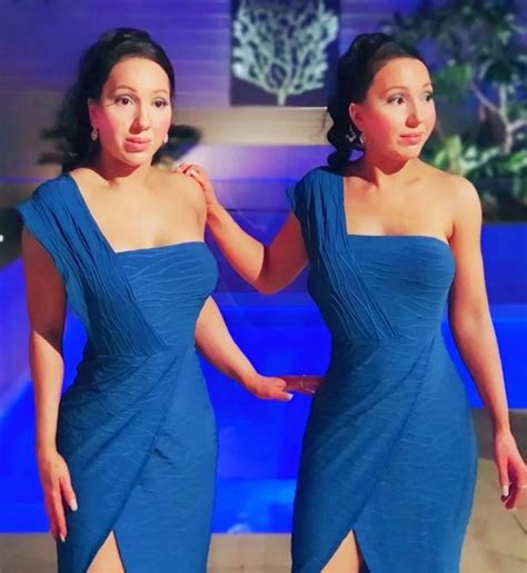 World S Most Identical Twins Pull Out Teeth At Same Time To Stay The Same Daily Star