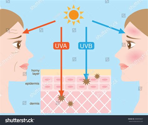 Infographic Skin Illustration Difference Between Uva Stock Vector Royalty Free 380899807
