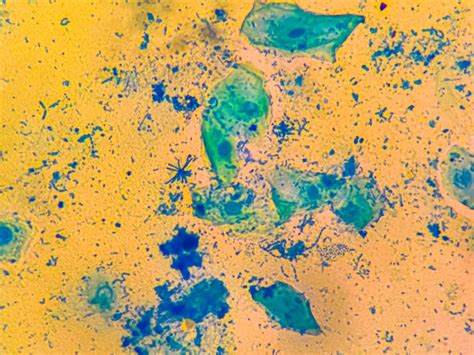 60 Enterococcus Faecium Foto Foto Stok Potret And Gambar Bebas Royalti Istock