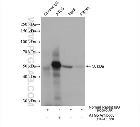Autophagy Essentials Antibody Kit Pk30004 Proteintech