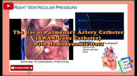 The Use Of Pulmonary Artery Catheterpac┊swan Ganz┊medical┊nurse