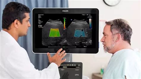 Quantifying Liver Fat With Ultrasound Philips