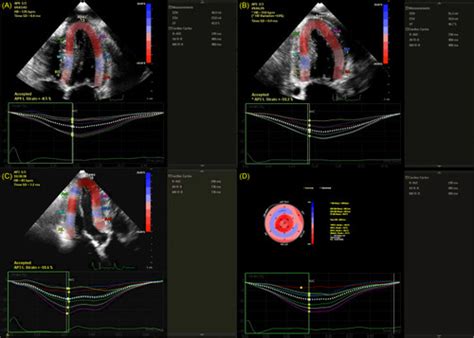 Physics 2 Quiz 1 Flashcards Quizlet