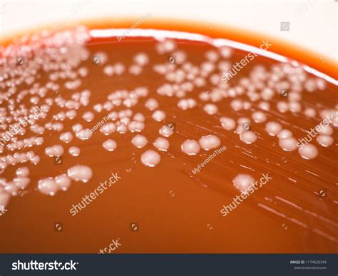 Cryptococcus Colony