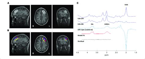 1h Mrs Voxel Position Tissue Segmentation And Representative