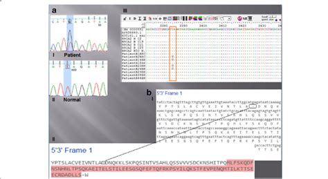 A I Patient Illustrates The Sequencing Result Of The Chromatogram Of Download Scientific