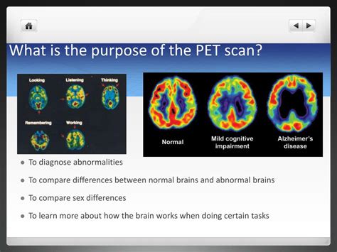 PPT PET SCAN PowerPoint Presentation Free Download ID