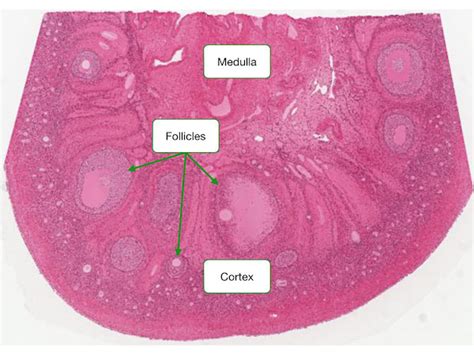 Ovary Slide Labeled Graafian Follicle
