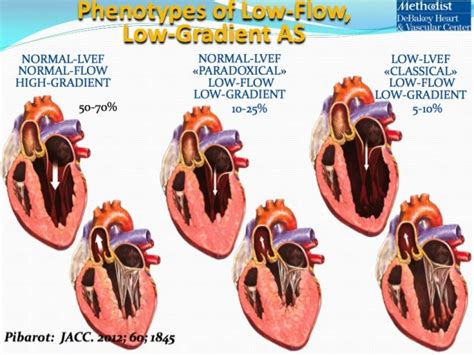 Low Normal Lv Function