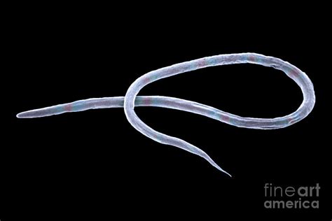 Vinegar Eel Coelom At Caitlyn Tooth Blog