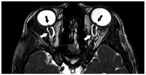 Three Dimensional Constructive Interference In Steady State 3d Ciss