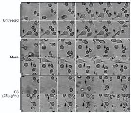 Video Time Lapse Microscopy Demonstrates That The Morphologically