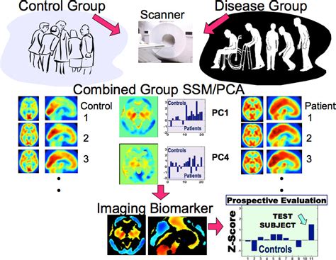 Identification Of Disease Related Spatial Covariance Patterns Using Neuroimaging Data Protocol