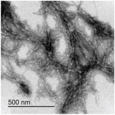 Tem Data Collected At The Plateau Of The Reactions Of Amyloid Fibril Download Scientific
