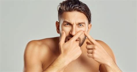 Tips On How To Prevent Pimples From Appearing Particle