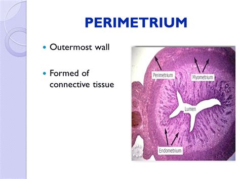 Perimetrium