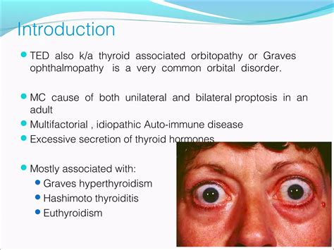 Thyroid Eye Disease Presentation Ppt