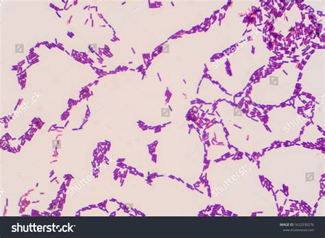 2 482 Gram Positive Bacillus Bilder Stockfotos Und Vektorgrafiken Shutterstock