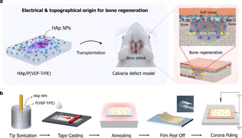 Korean Scientists Develop Novel Bone Bandage Material For Cracked Bones