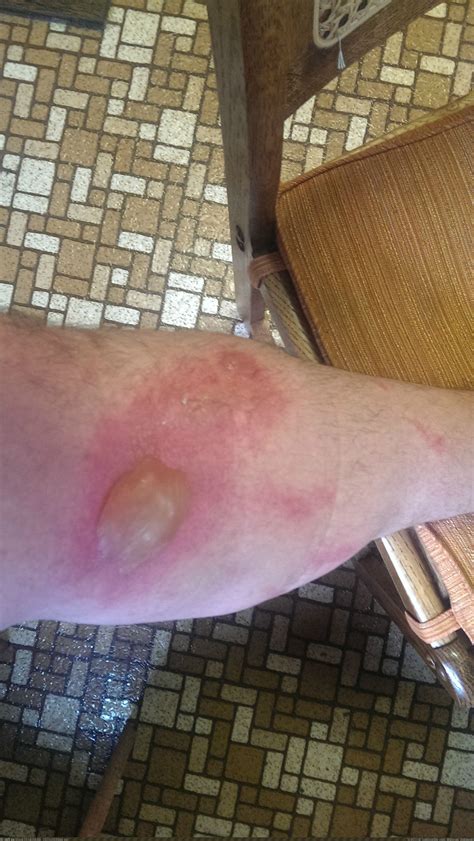 Pic Wtf Run Pushki Cow Parsnip 575988b Wtf My Run In With