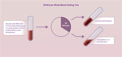 Case 1 2024 A 25 Year Old Pregnant Woman With Bleeding After A