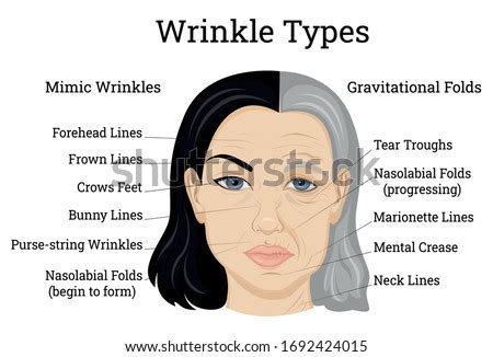 WRINKLES TYPES Stock Vector Images Avopix Com