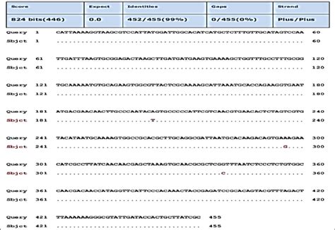 multiple sequence alignment analysis of the mete gene in auxotroph s p