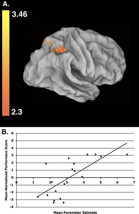 Learning Related Activations In Right Intraparietal Cortex Among