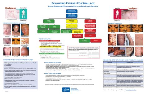 Evaluating Patients For Smallpox Acute Generalized Vesicular Or