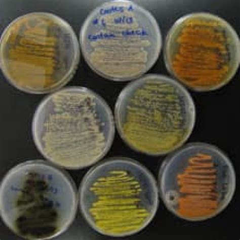 Antibiotic Resistance Found In Ancient Bacteria Cbc News